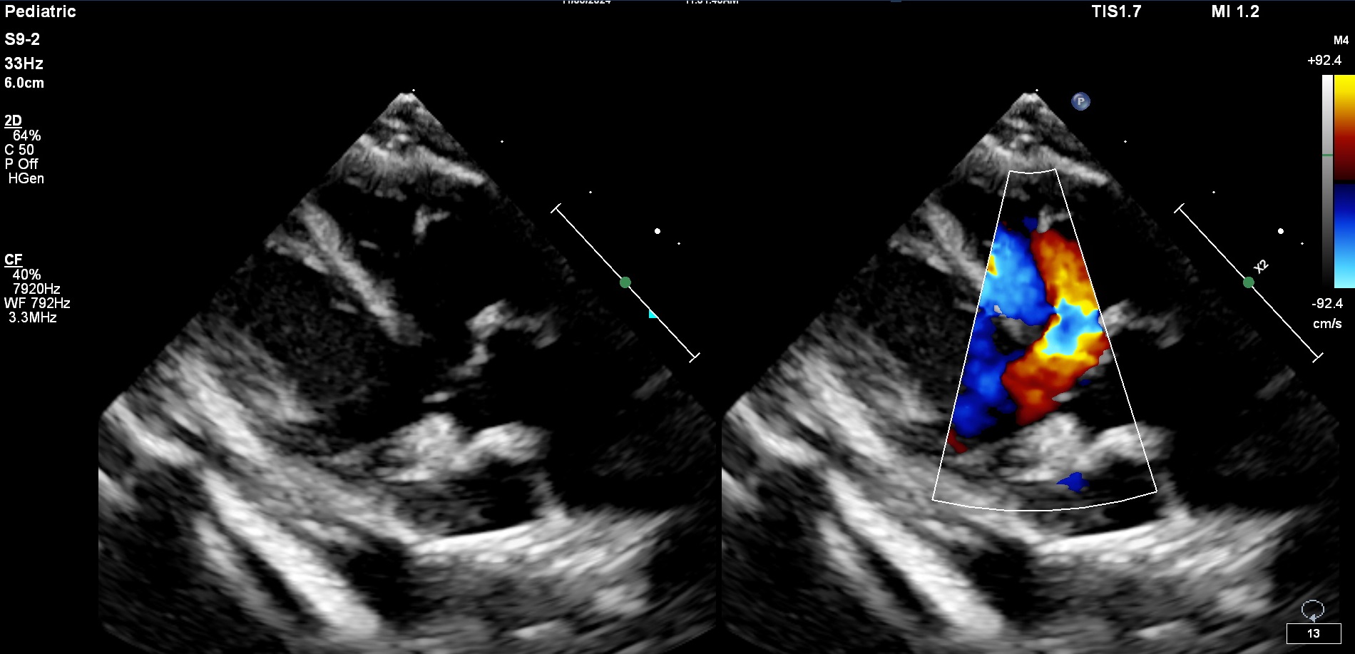 Ventricular Septal Defect Apex Vet Specialists 3097